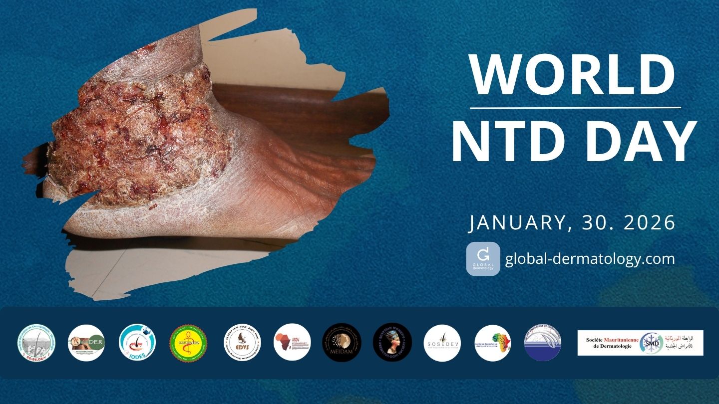 Skin NTD | WD 2026 - Event - Global Dermatology