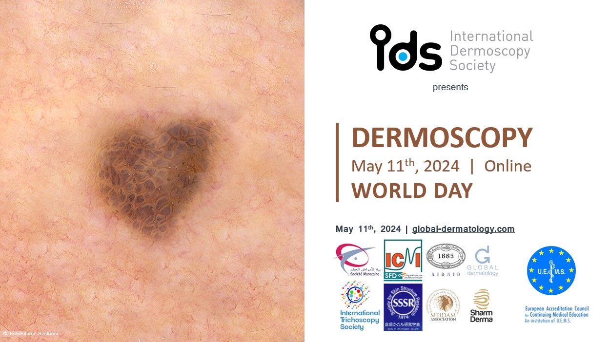 DERMOSCOPY | World Day 2024 - Global Dermatology