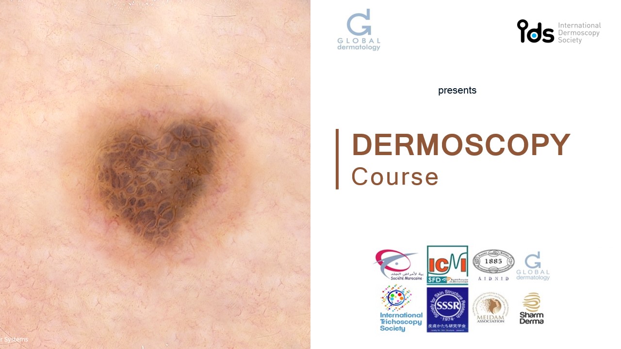 Dermoscopy - Course - Global Dermatology
