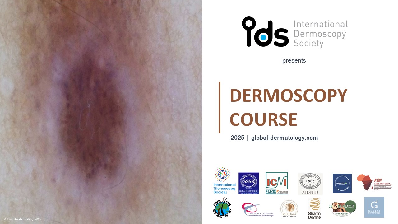 Topographic Dermoscopy - Course - Global Dermatology